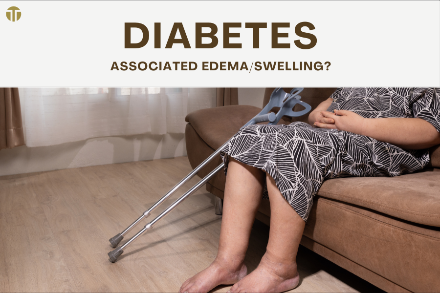 Managing Diabetes with Compression Therapy: Benefits for Circulation ...
