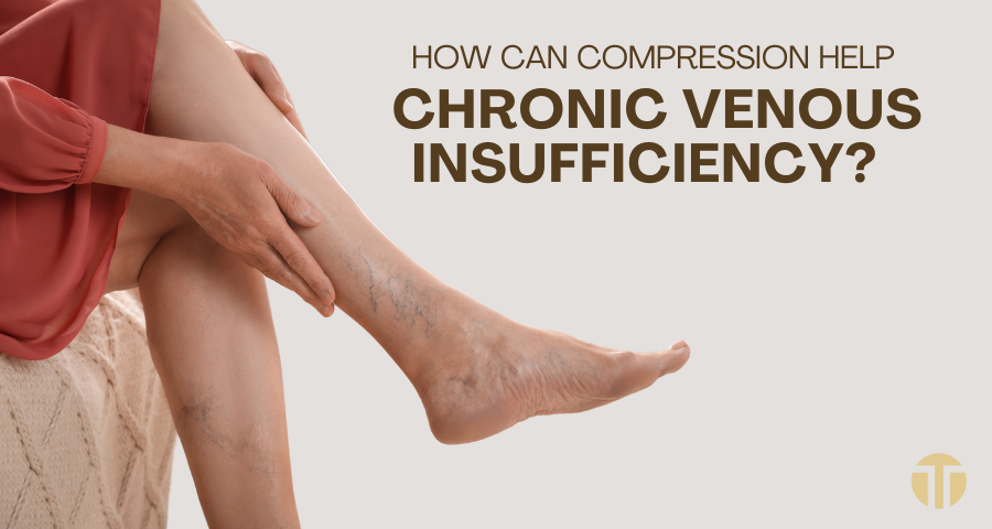 Managing Chronic Venous Insufficiency (CVI) with Compression Wear ...